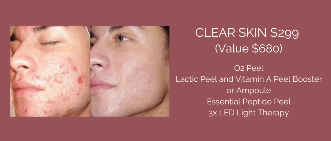 Special Offers - Indulgence