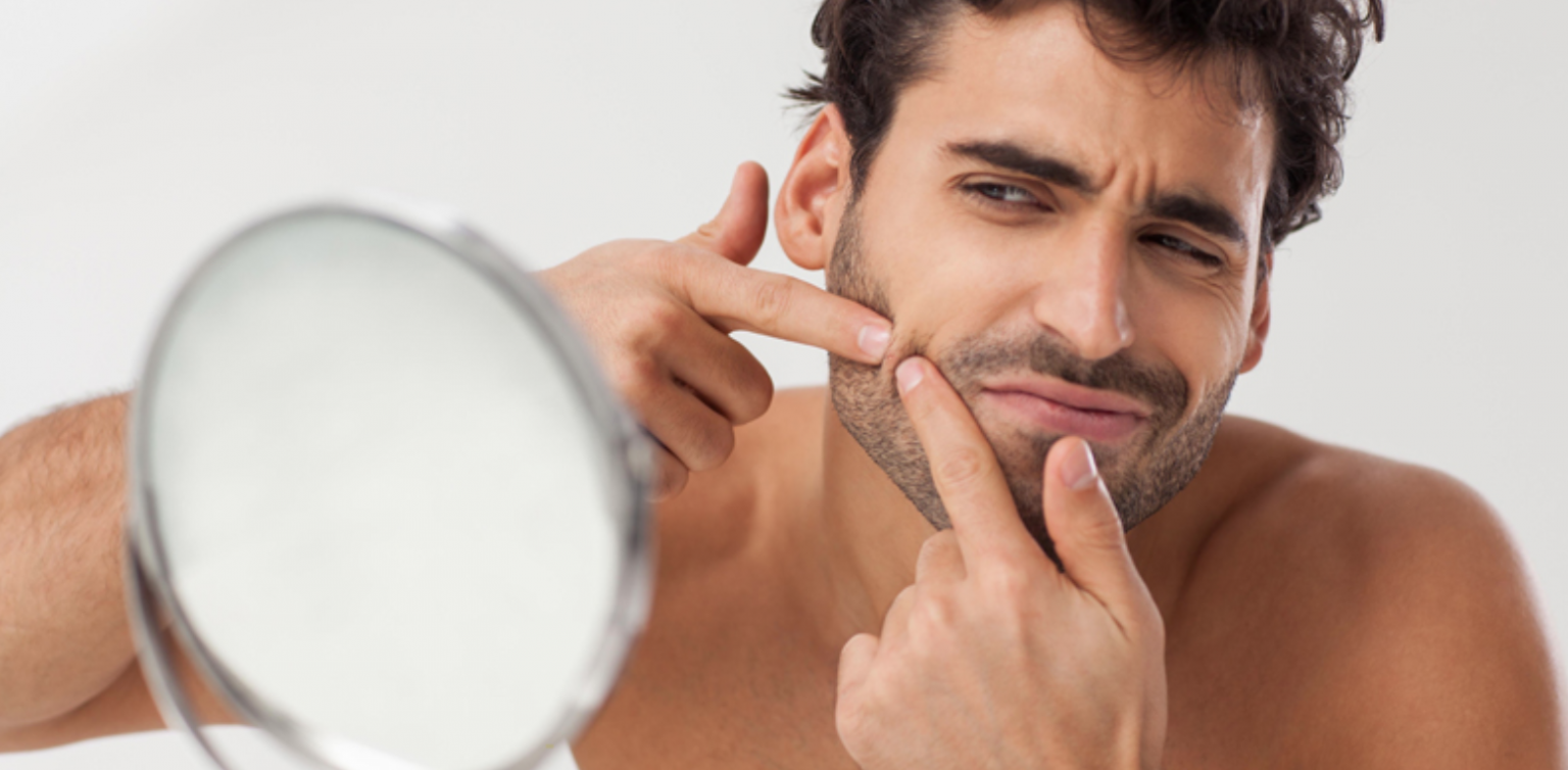 The Right Way to Pop a Pimple